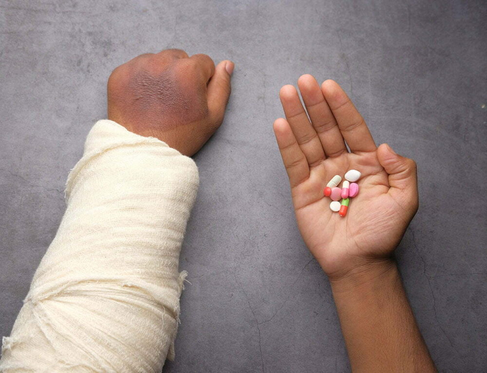 The CAROC Score for Assessing Fracture Risk | Marodyne